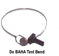 Baha - informatie en ervaringen over de BAHA, het botverankerd hoortoestel.